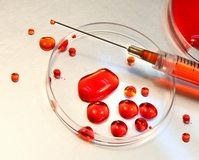 Kan testiyle erken evrede parkinson teşhisi artık mümkün!