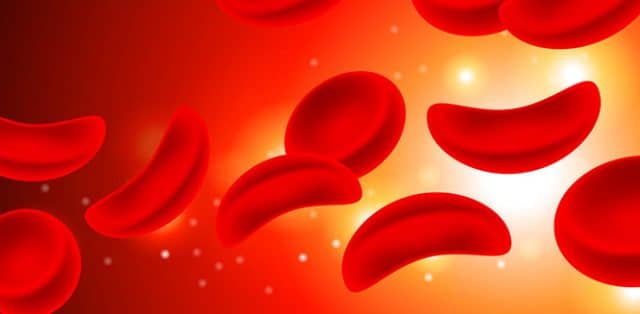 Talasemi (Akdeniz anemisi) Türkiye için çok önemli bir sorun