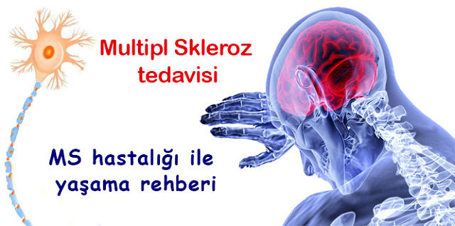 Multipl Skleroz | Medikal Akademi