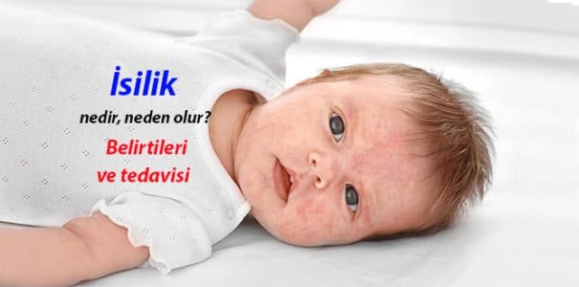 Bebek Sağlığı | Medikal Akademi