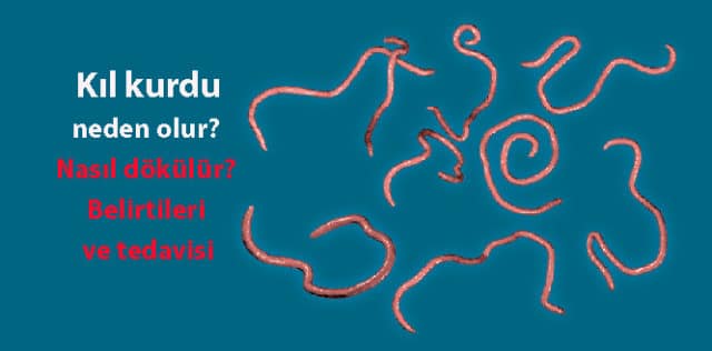 Kıl kurdu neden olur? Nasıl dökülür? Belirtileri ve tedavisi