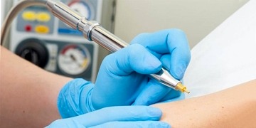 Kriyoterapi nedir? Nasıl uygulanır? Avantaj ve riskleri