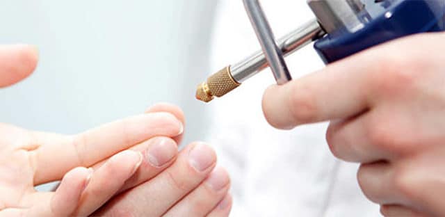 Kriyoterapi nedir? Nasıl uygulanır? Avantaj ve riskleri