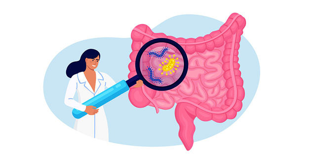Kolit nedir? Neden olur? Kolitin belirtileri ve tedavisi