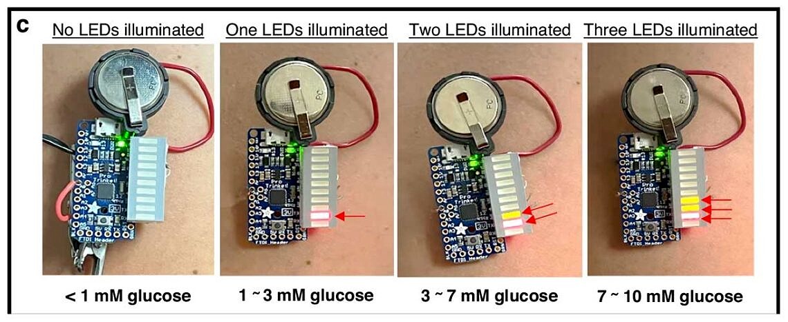 Terden Kan Şekeri Ölçen Sensör ile Parmak Delmeye Gerek Kalmayacak!